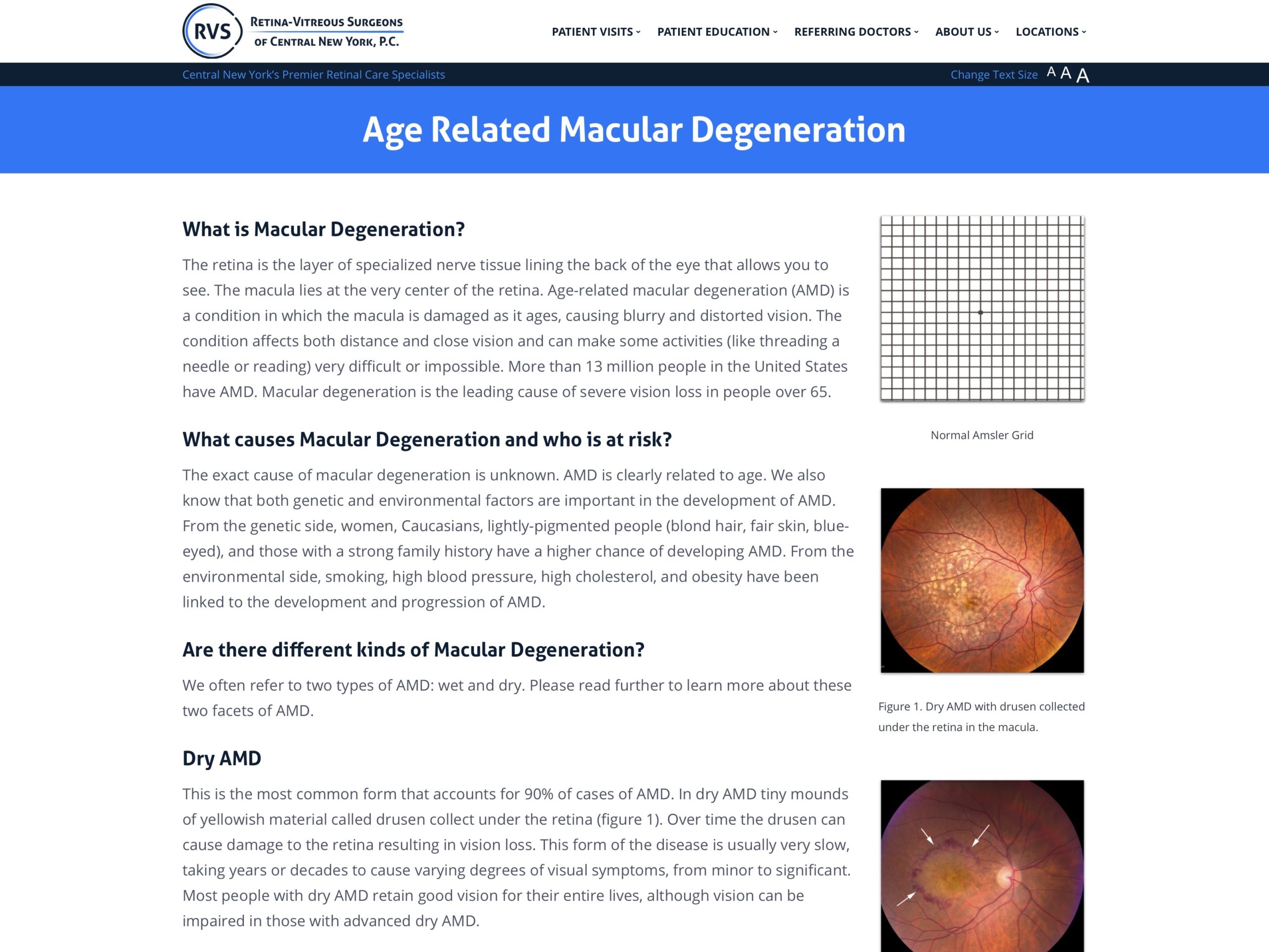 Age Related Macular Degeneration Pictures age-related-macular-degeneration-pictures