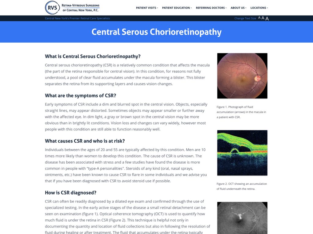 Central Serous Chorioretinopathy | Retina-Vitreous Surgeons of CNY
