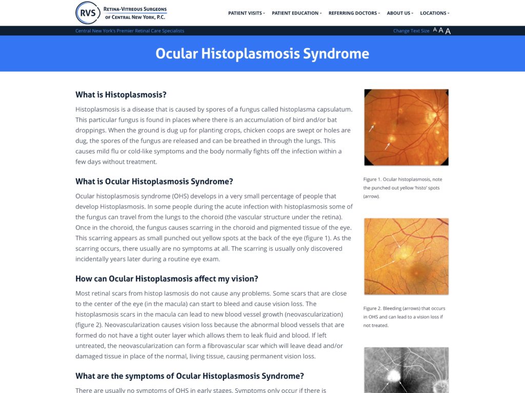 Ocular Histoplasmosis Syndrome | Retina-Vitreous Surgeons of CNY