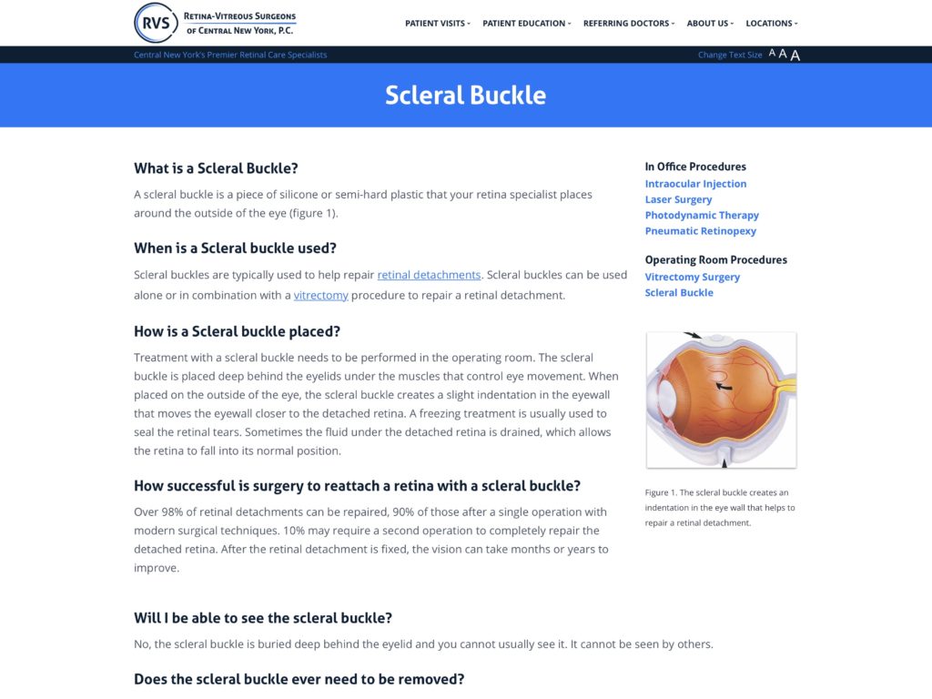 Scleral Buckle | Retina-Vitreous Surgeons of CNY