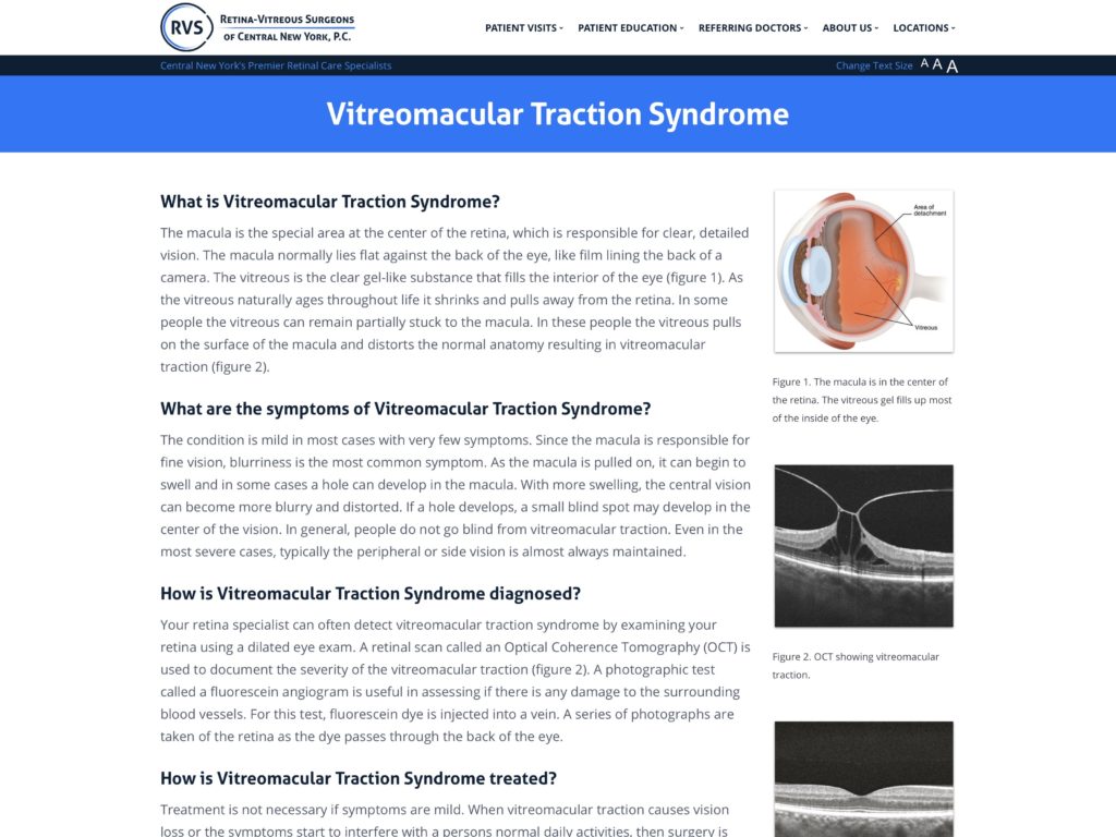 Vitreomacular Traction Syndrome | Retina-Vitreous Surgeons of CNY
